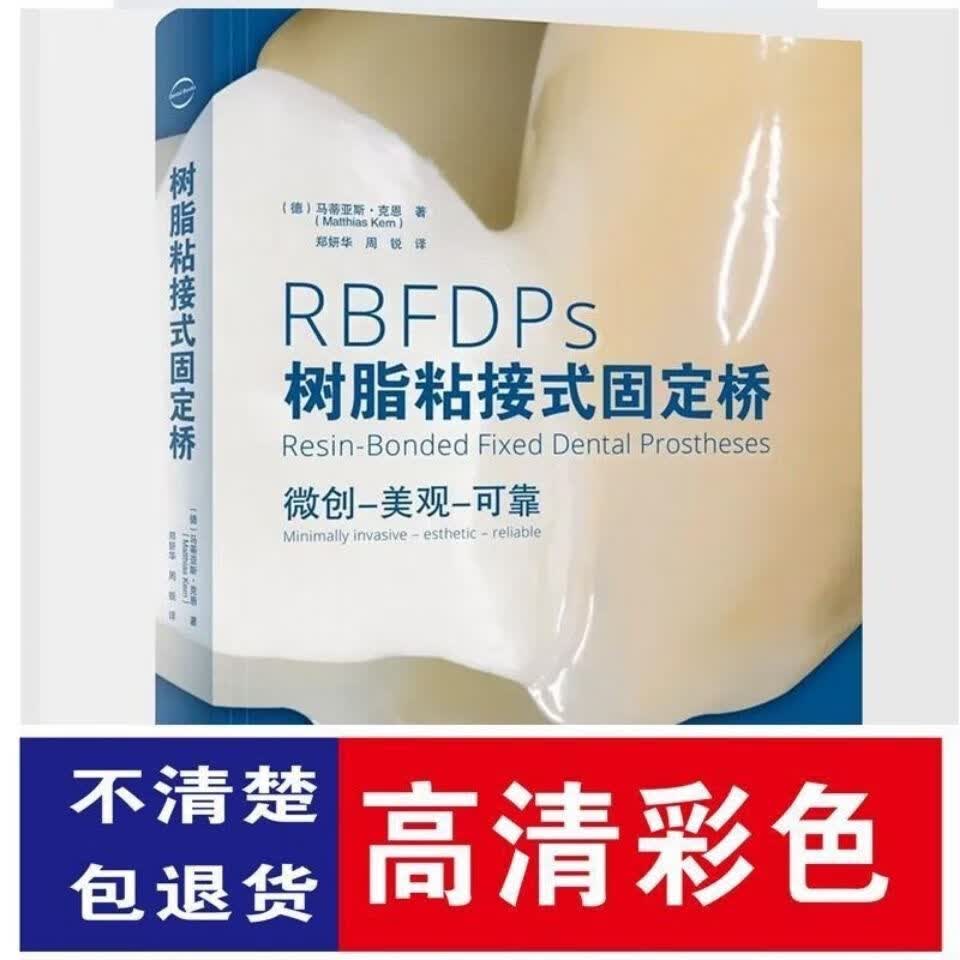 高清彩色 树脂粘接式固定桥