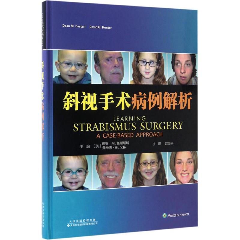 斜视手术病例解析