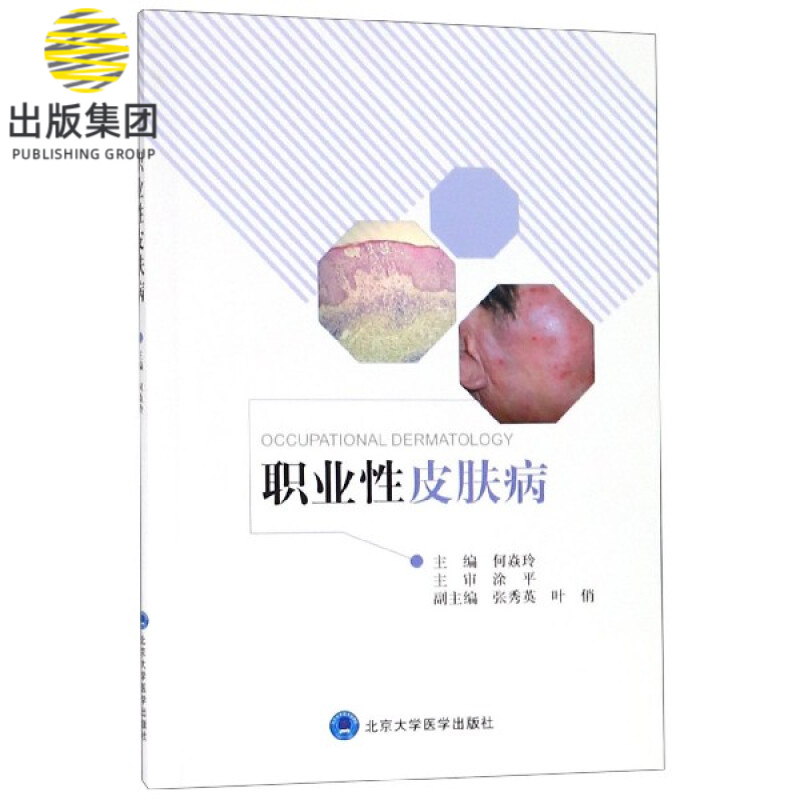 职业性皮肤病