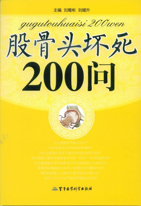 股骨头坏死200问