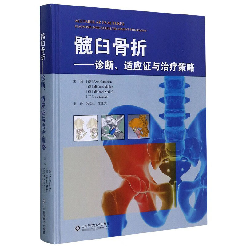 髋臼骨折--诊断适应证与治疗策略(精)