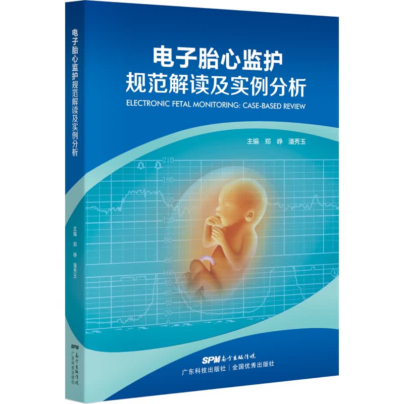 电子胎心监护规范解读及实例分析 图书