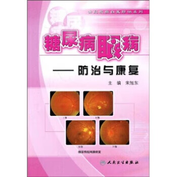 常见眼病自我防治系列·糖尿病眼病·防治与康复 宋旭东 著 人民卫生出版社