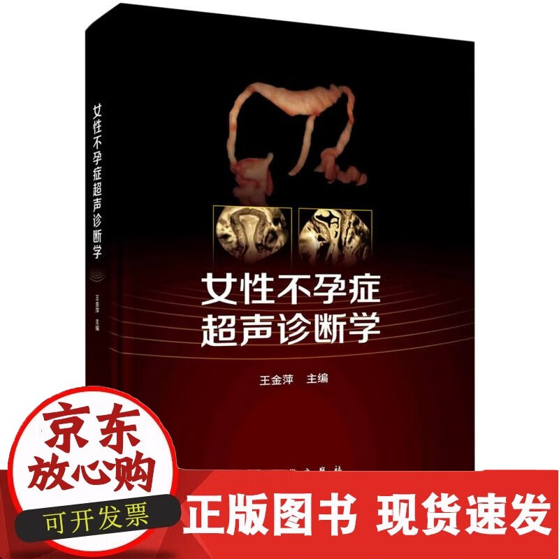 女性不孕症超声诊断学