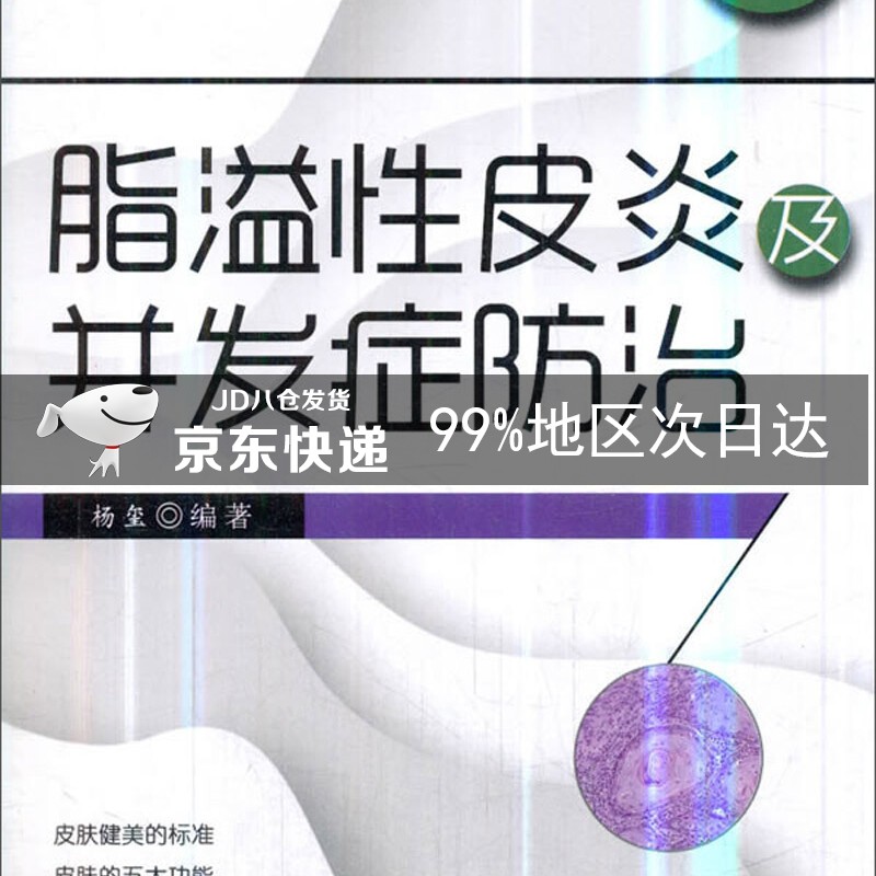 脂溢性皮炎及并发症防治