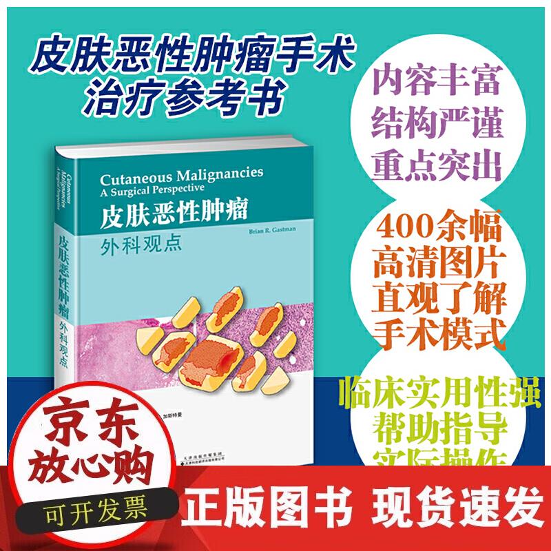【现货】皮肤恶性肿瘤：外科观点