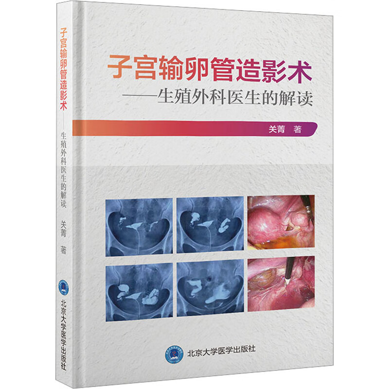 子宫输卵管造影术——生殖外科医生的解读 图书