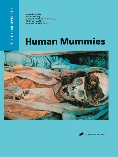 Human Mummies