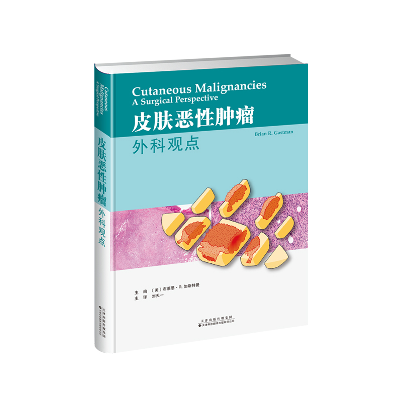 皮肤恶性肿瘤 外科观点