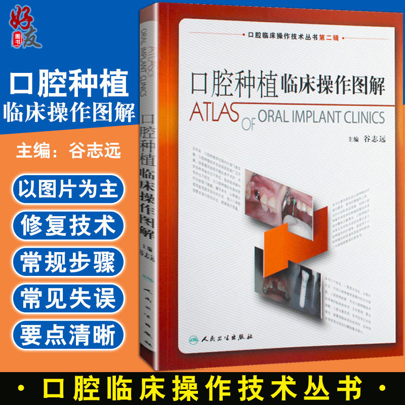 口腔种植临床操作图解 口腔临床操作技术丛书 谷志远主编 人民卫生出版社9787117129831