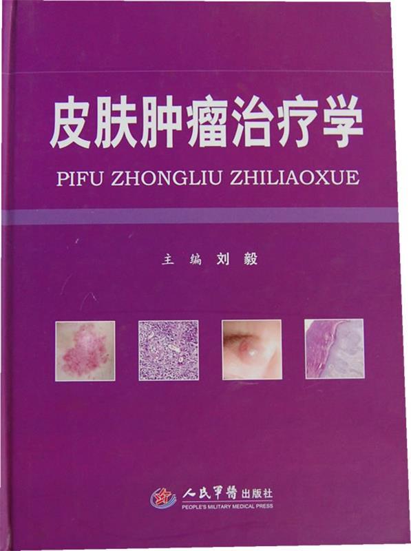 皮肤肿瘤治疗学 刘毅主编