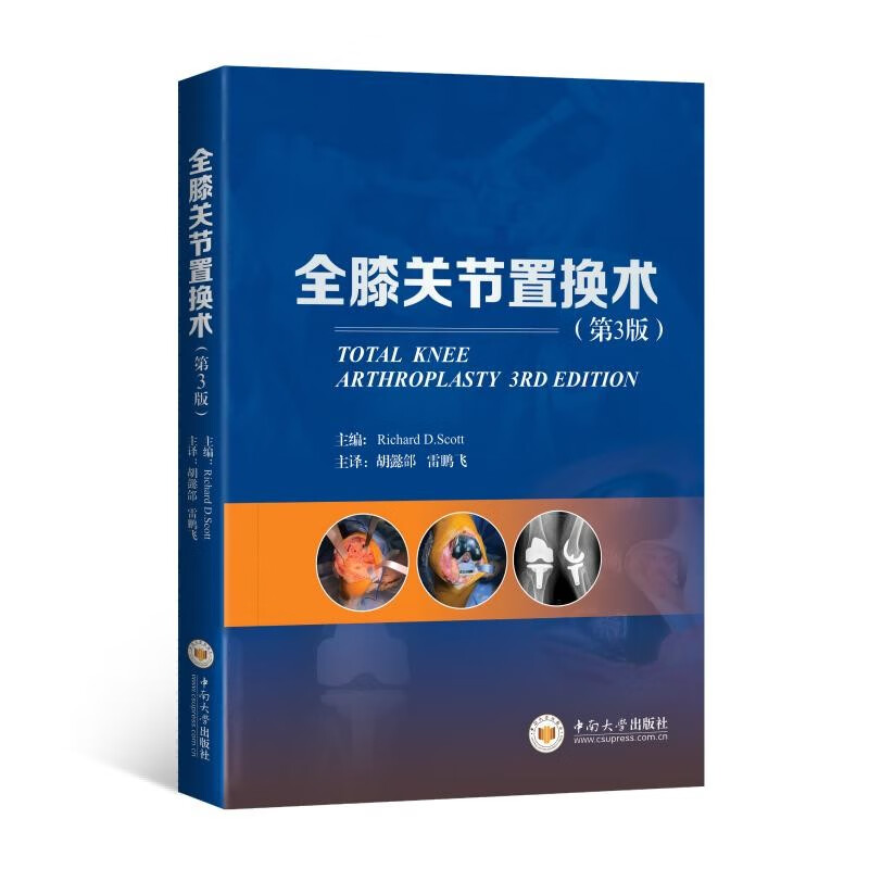 全膝关节置换术（第3版）