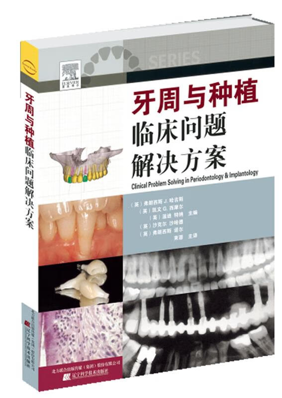 牙周与种植临床问题解决方案