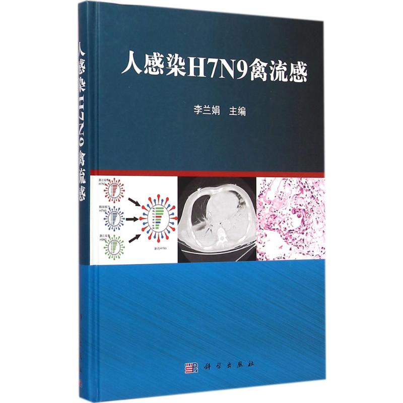 人感染H7N9禽流感