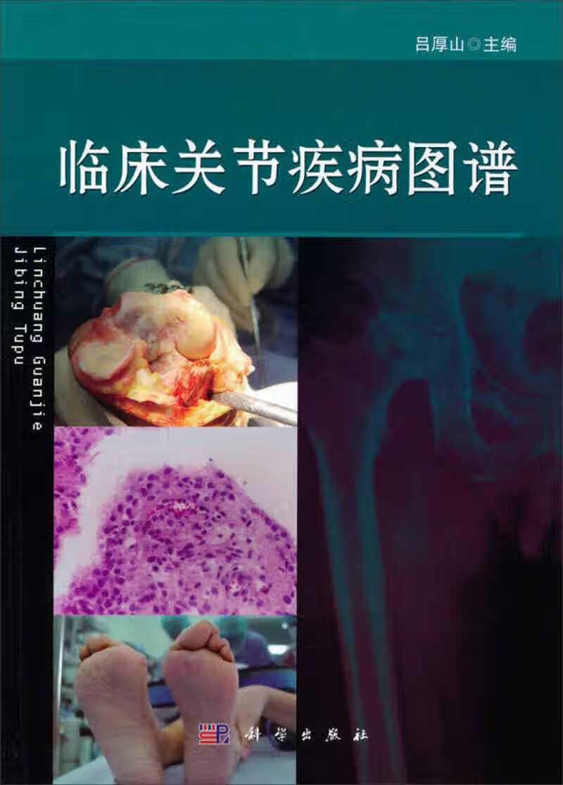 临床关节疾病图谱【好书】