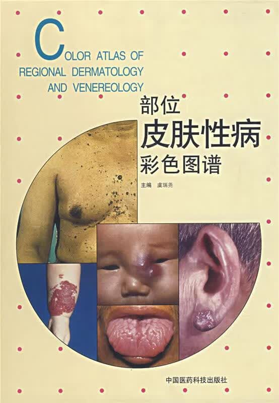 ！部位皮肤性病彩色图谱 ，虞瑞尧编著 9787506720038 中国医药科技出版社