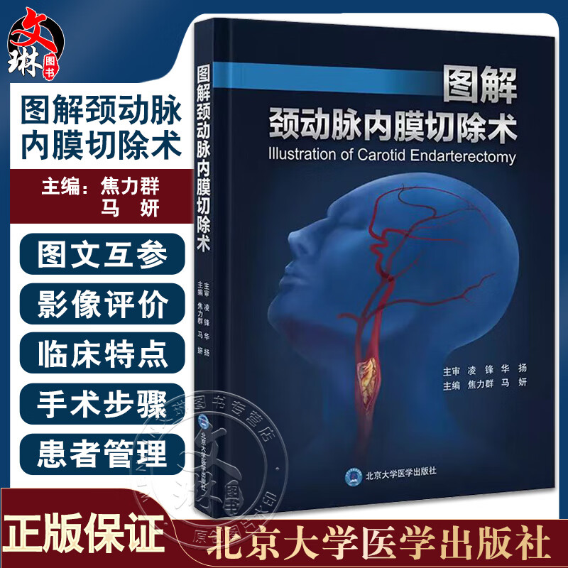 图解颈动脉内膜切除术 焦力群 马妍 宣武医院脑缺血治疗系列丛书 围术期影像学评估手术操作细节 北京大学医学出版社9787565927652