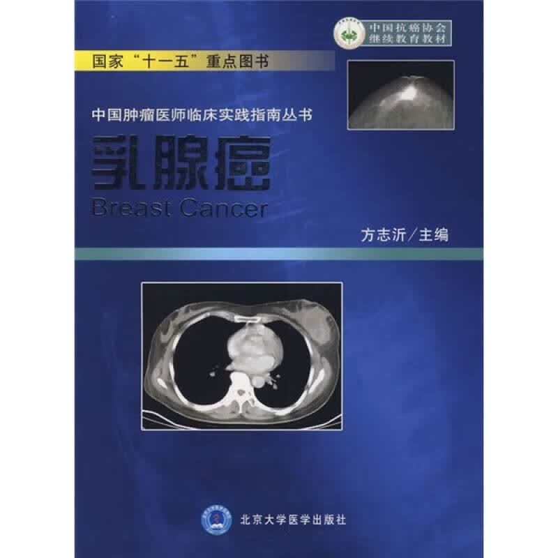 乳腺癌【精选】