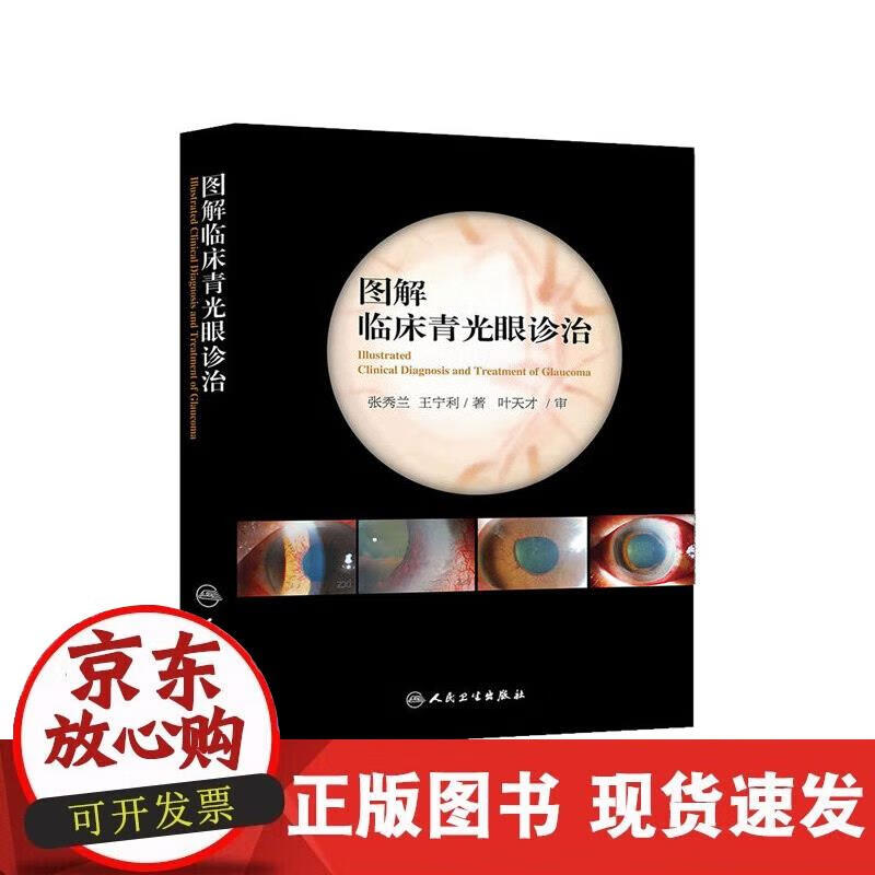 【现货】图解临床青光眼诊治