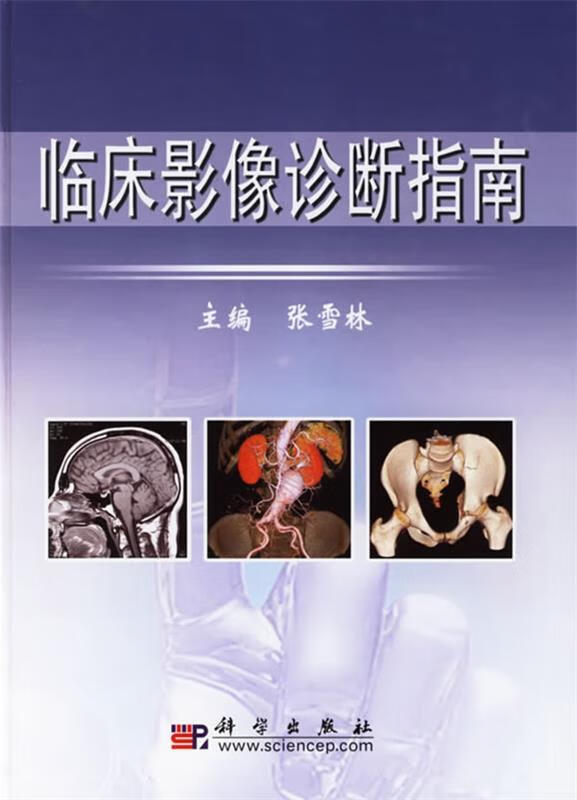 临床影像诊断指南 张雪林 主编