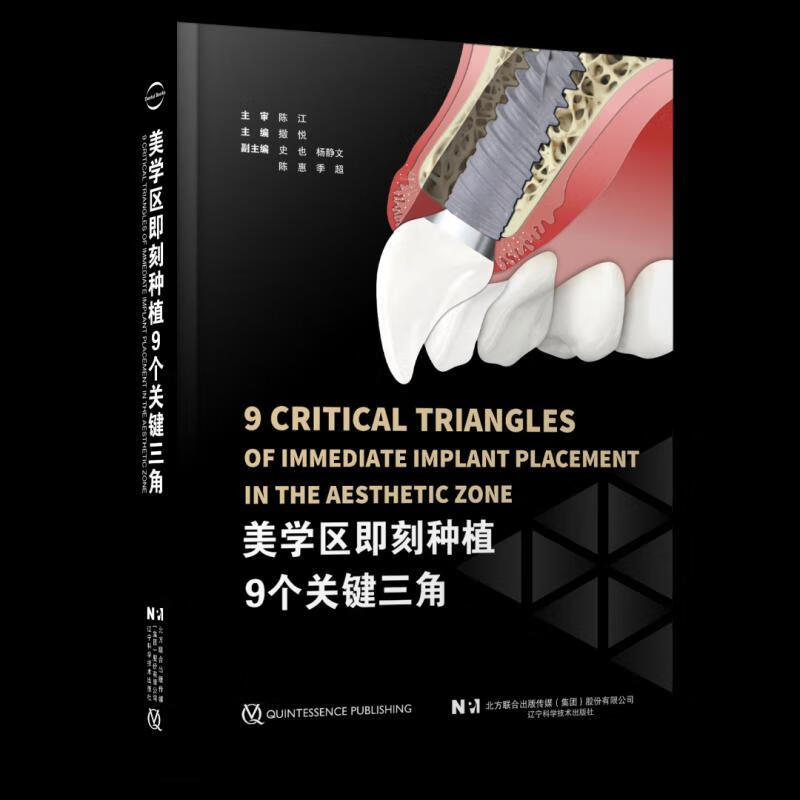 美学区即刻种植9个关键三角 默认