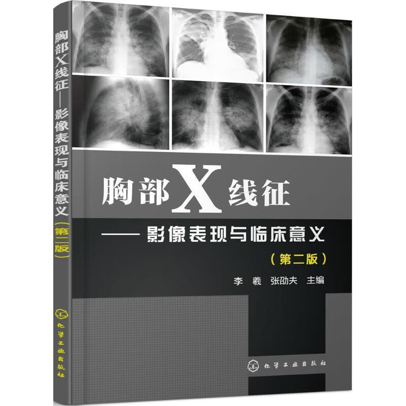 胸部X线征--影像表现与临床意义 李羲,张劭夫 著 化学工业出版社