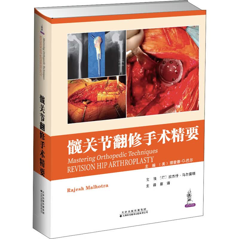 髋关节翻修手术精要