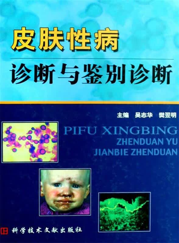 皮肤性病诊断与鉴别诊断