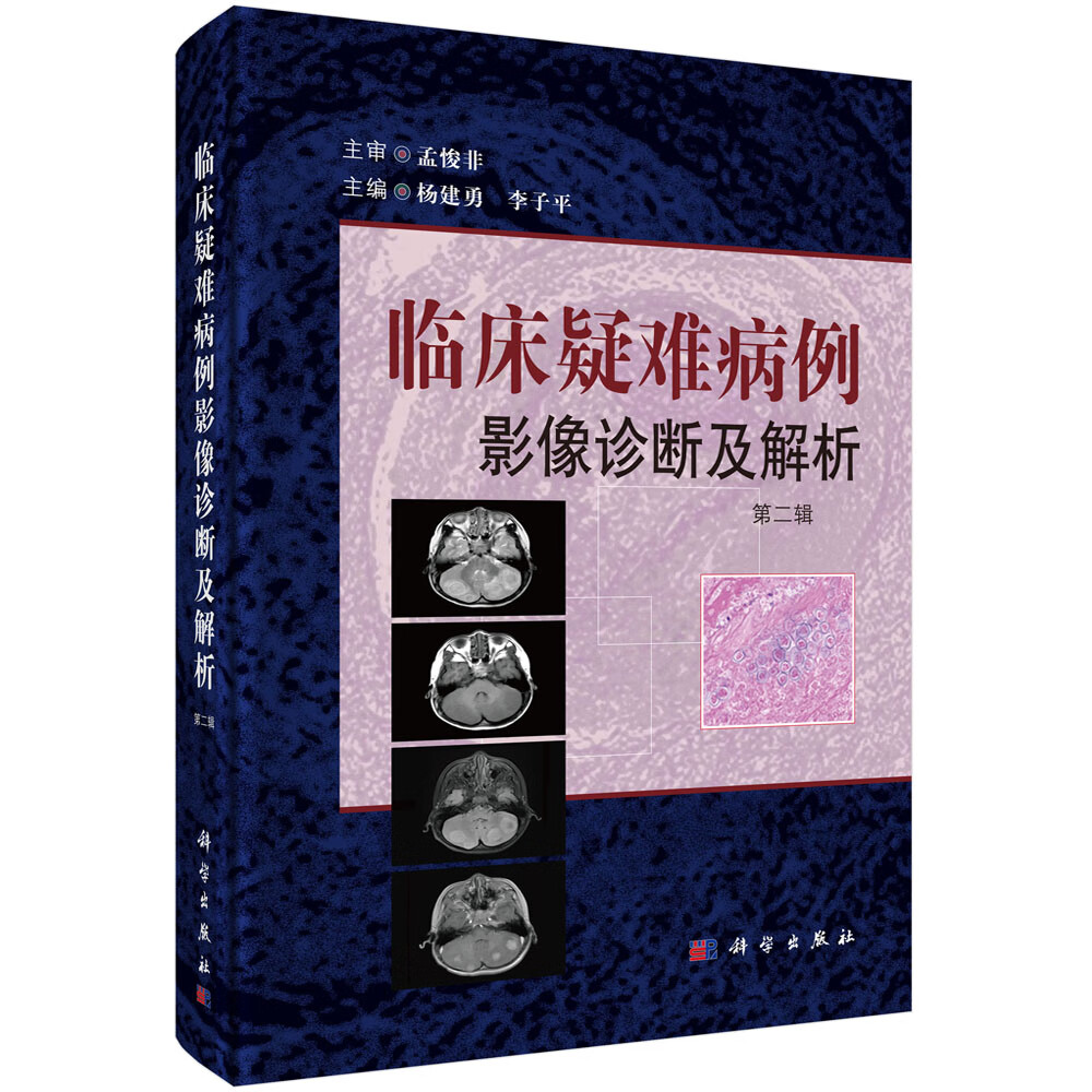 临床疑难病例影像诊断及解析 （第二辑)