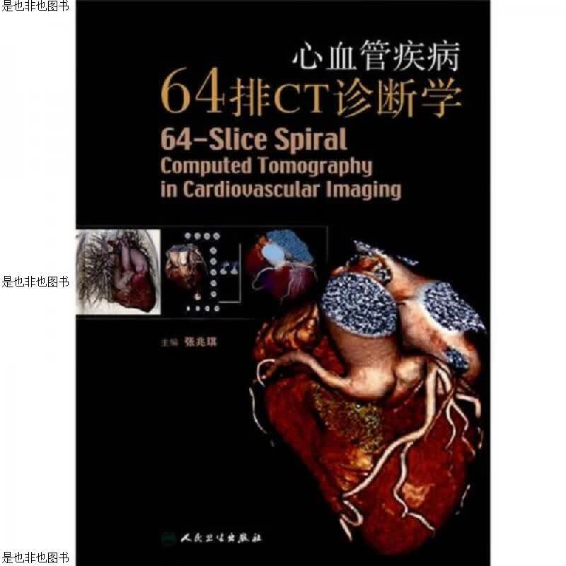 心血管疾病64排CT诊断学