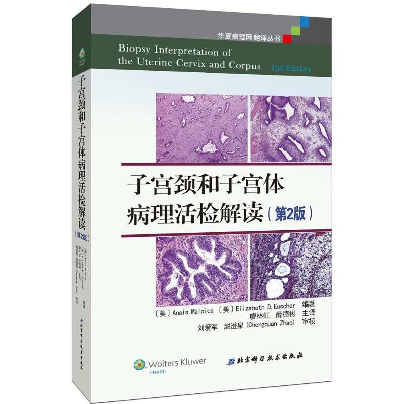 子宫颈和子宫体病理活检解读