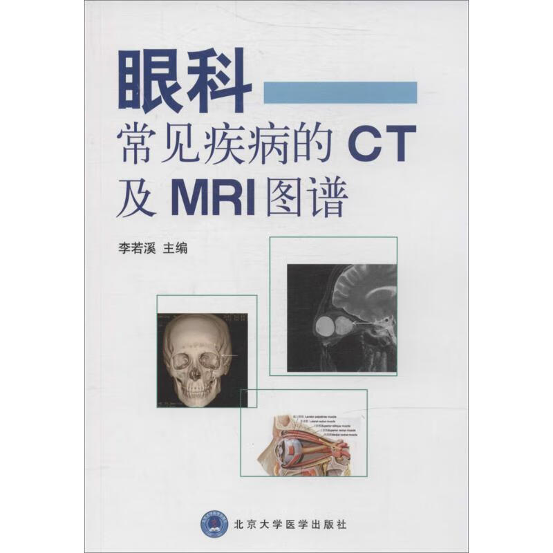 眼科常见疾病的CT及MRI图谱【，放心购买】