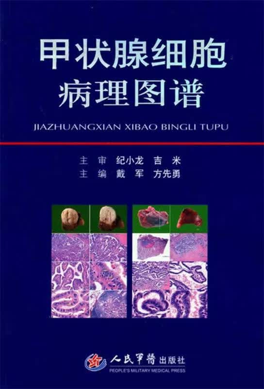 甲状腺细胞病理图谱 戴军,方先勇主编 人民军医出版社 9787509161807