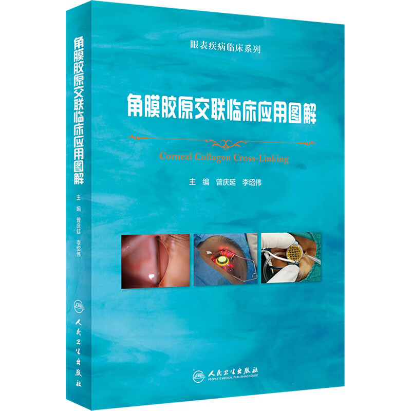角膜胶原交联临床应用图解