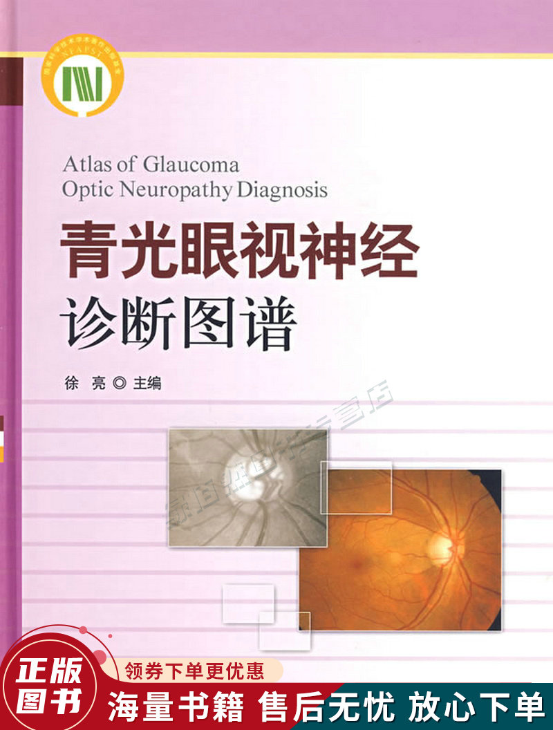 青光眼视神经诊断图谱