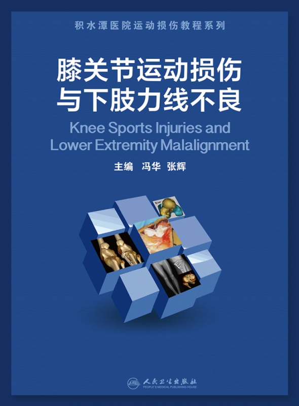 膝关节运动损伤与下肢力线不良(配增值) 冯华,张辉