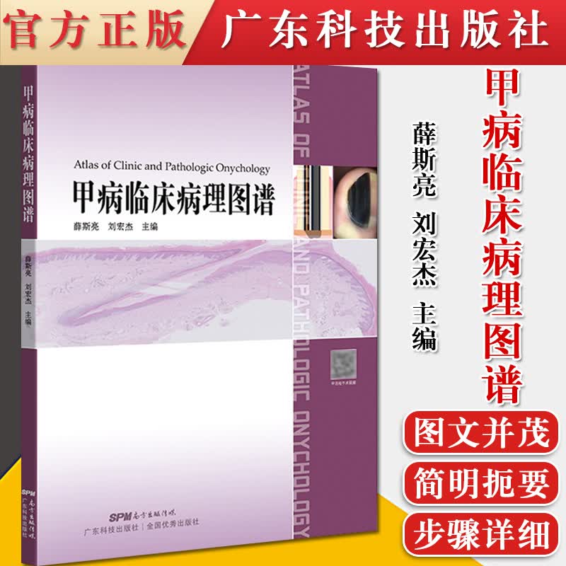 K书籍 甲病临床病理图谱 简明扼要地介绍甲病的专业知识 涵盖绝大多数临床常见的甲病