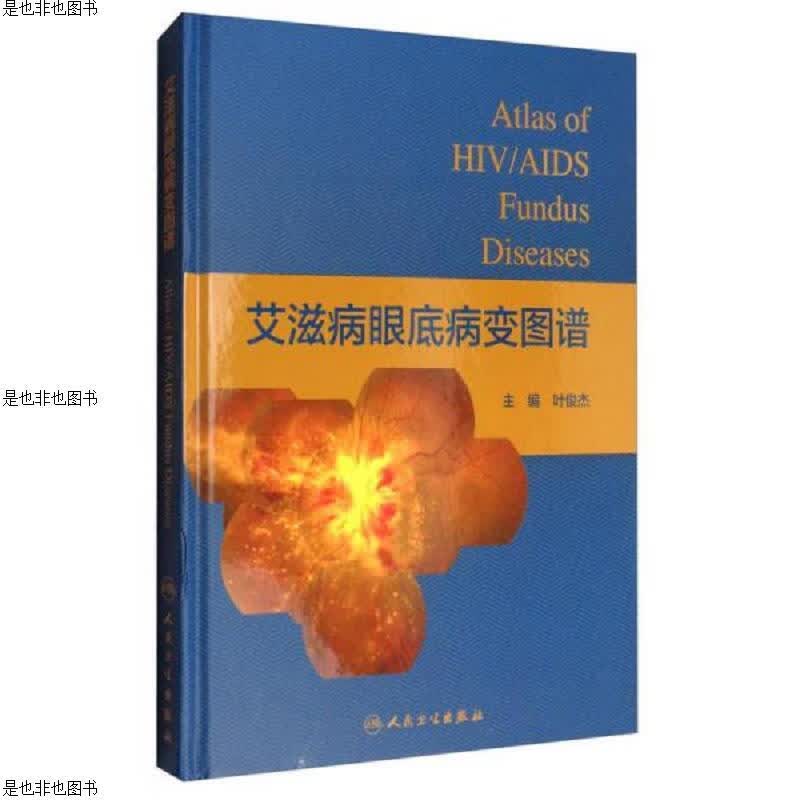 *眼底病变图谱(没有书皮)
