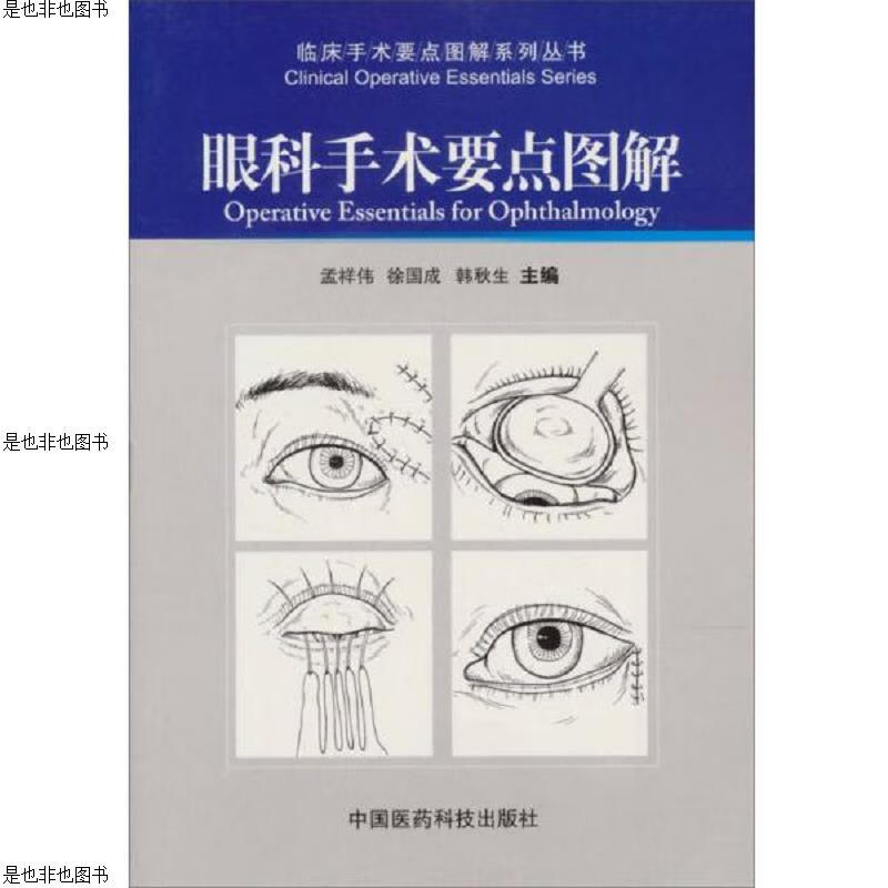 眼科手术要点图解