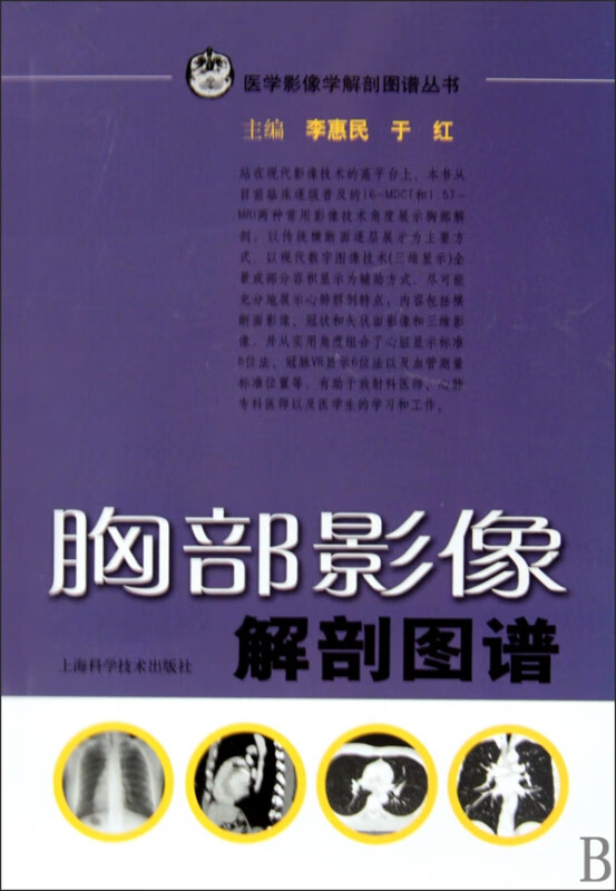 胸部影像解剖图谱/医学影像学解剖图谱丛书