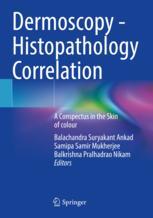 Dermoscopy - Histopathology Correlation