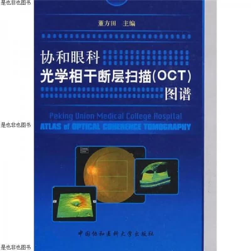 协和眼科光学相干断层扫描(OCT)图谱