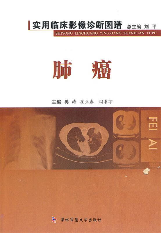 肺癌--实用临床影像诊断图谱