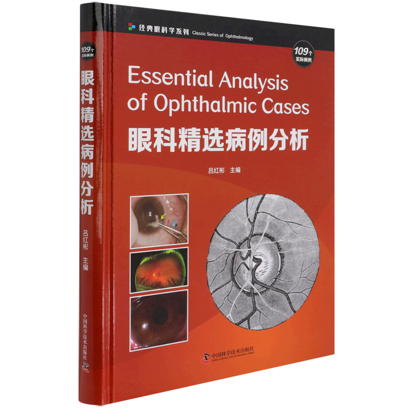 眼科精选病例分析(精)/经典眼科学系列