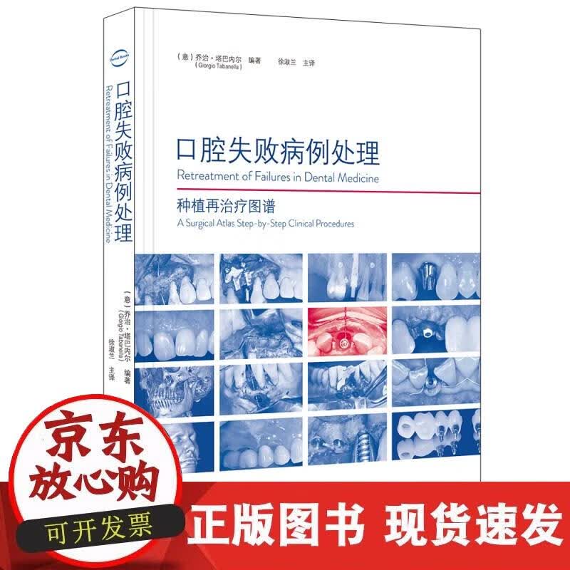 【现货】口腔失败病例处理