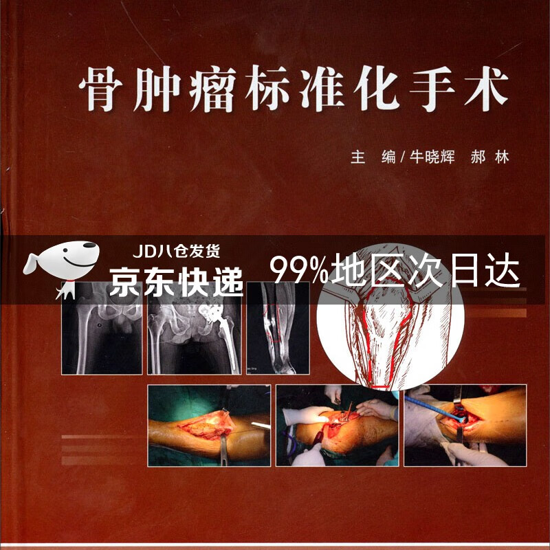 骨肿瘤标准化手术（附DVD光盘）