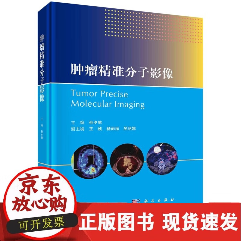 肿瘤精准分子影像
