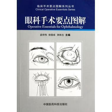 眼科手术要点图解 孟祥伟,徐国成,韩秋生 中国医药科技出版社 9787506751704