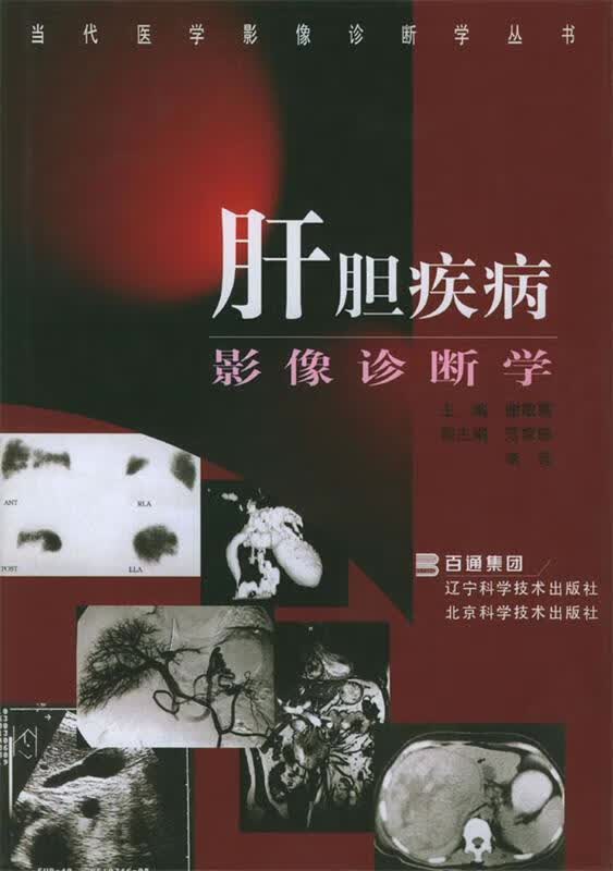 肝胆疾病影像诊断学