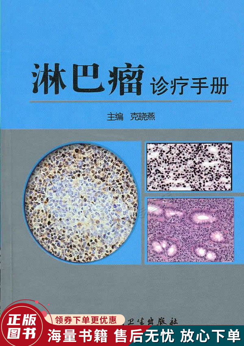 淋巴瘤诊疗手册